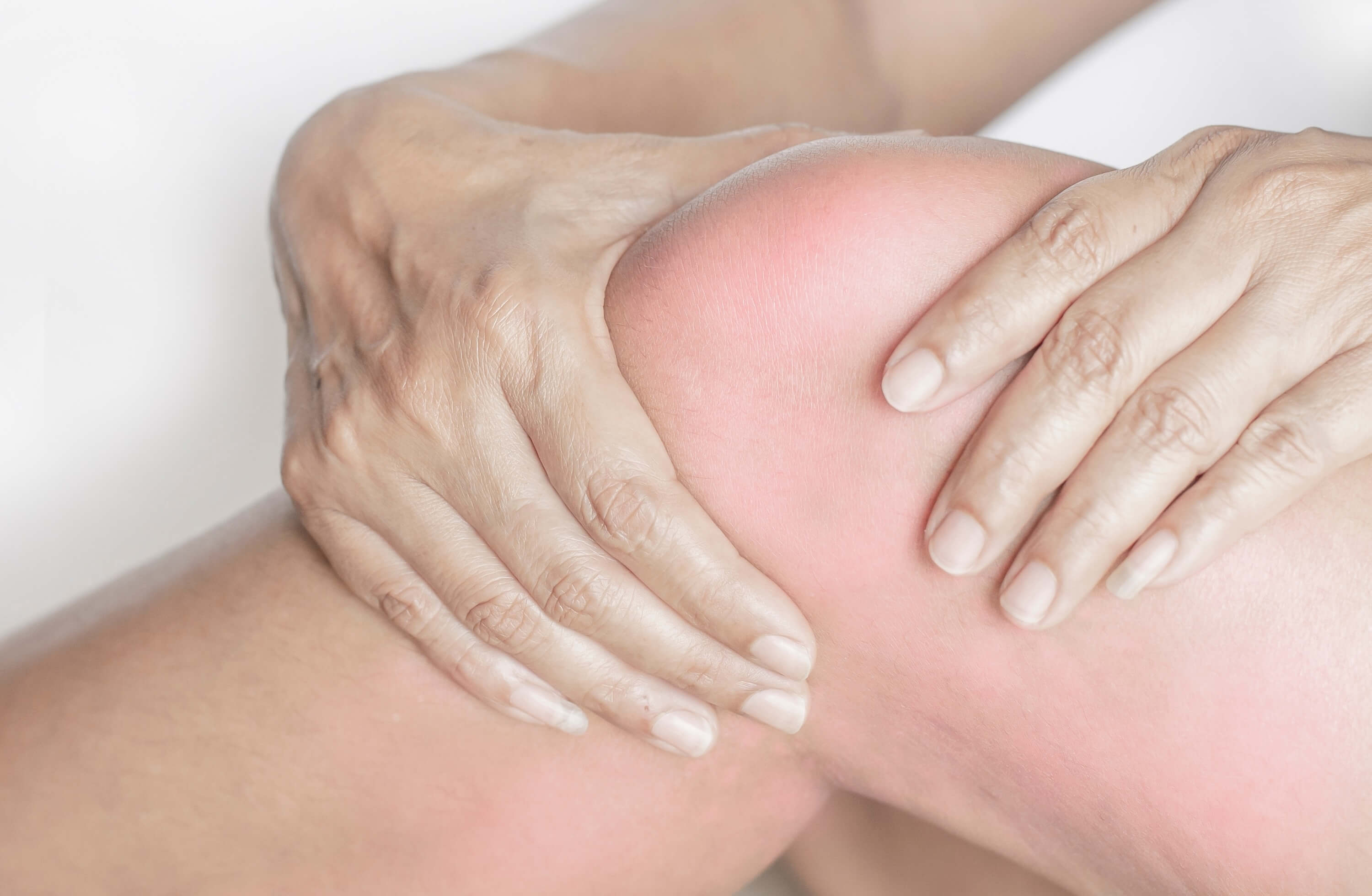 What Are Bone Bruises And Can Physical Therapy Treat Them 
